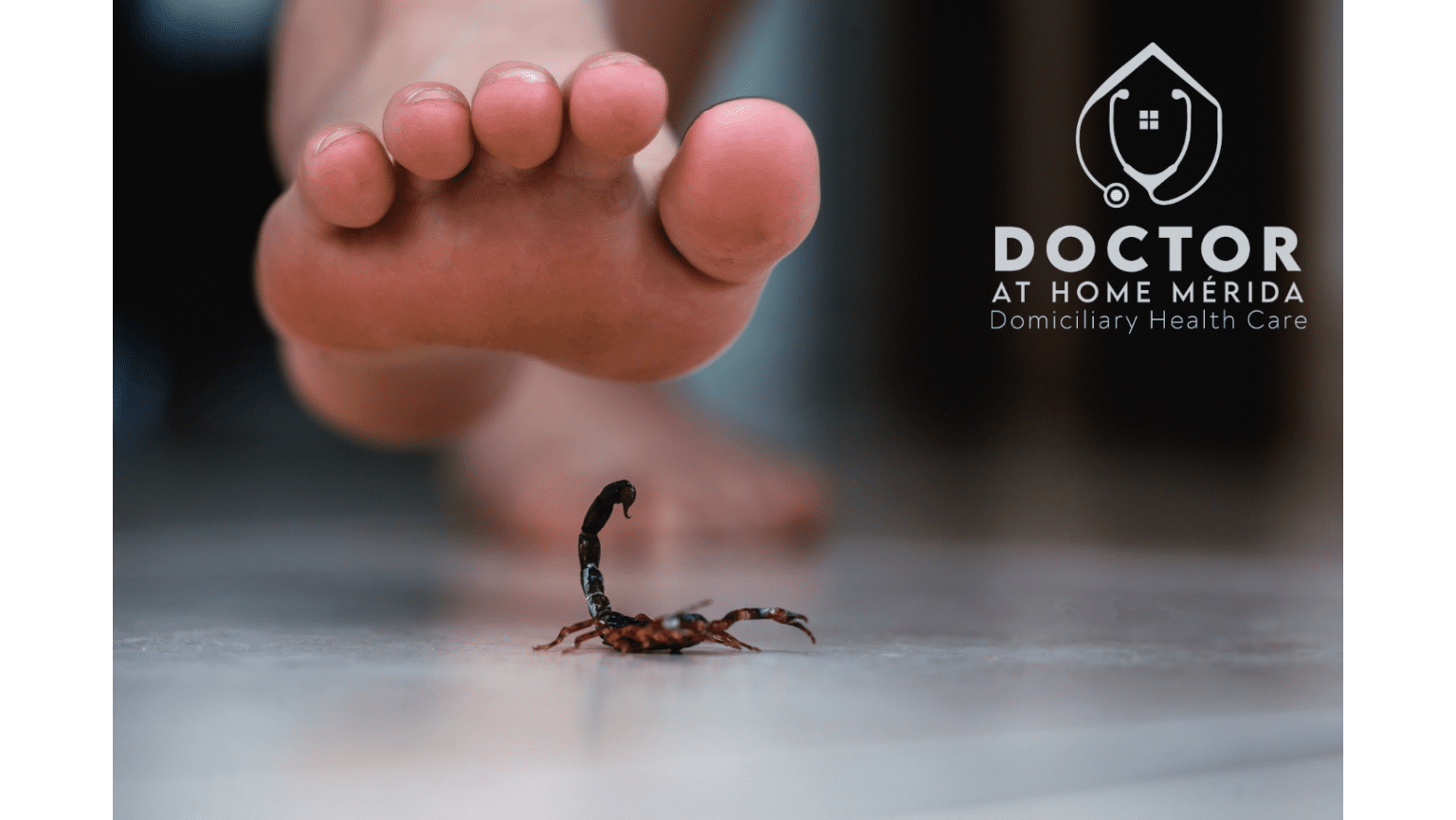 Scorpion sting | Doctor At Home Mérida